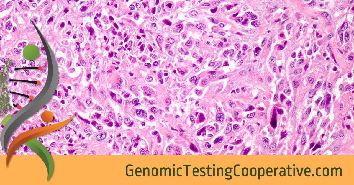 Sarcoma Diagnosis And Classification | Genomic Testing Cooperative