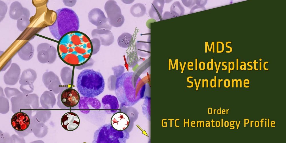 Myelodysplastic Syndrome (MDS) | Genomic Testing Cooperative